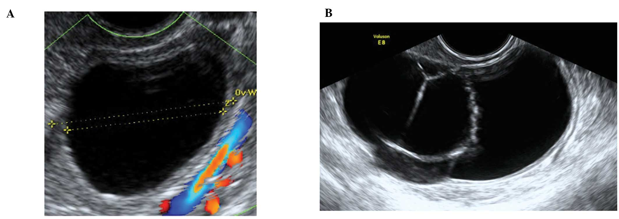 자궁내막증으로 보고 수술할수는 없나요? - 2016 PE 산부인과 15번 | 메디톡
