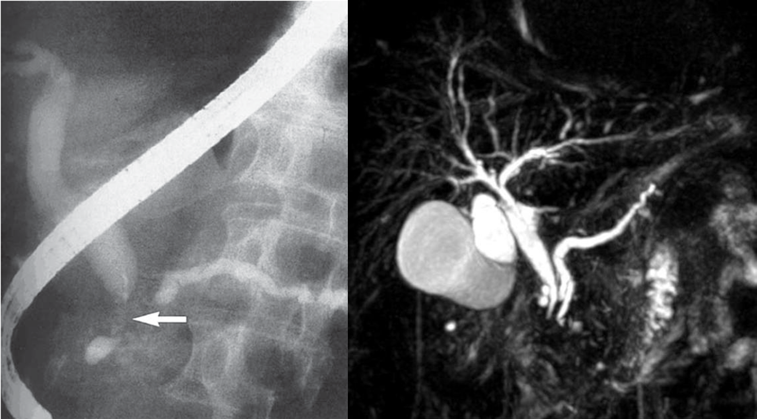 췌장두부암이 아닌 이유는 뭔가요? - 2024 PE 내과 7번 | 메디톡