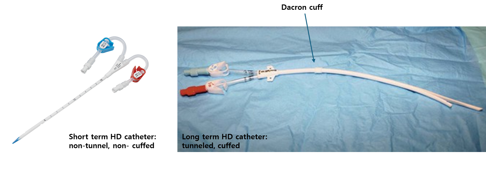 이건 exit site infection 아닌가요?? - 2024 PE 외과 18번 | 메디톡